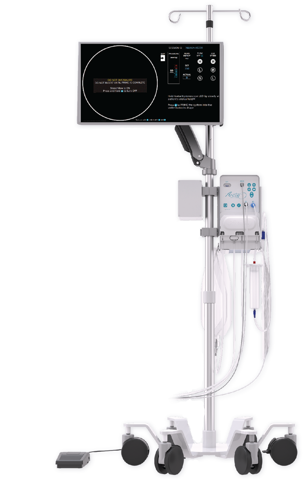 Aveta® System — Aveta® System