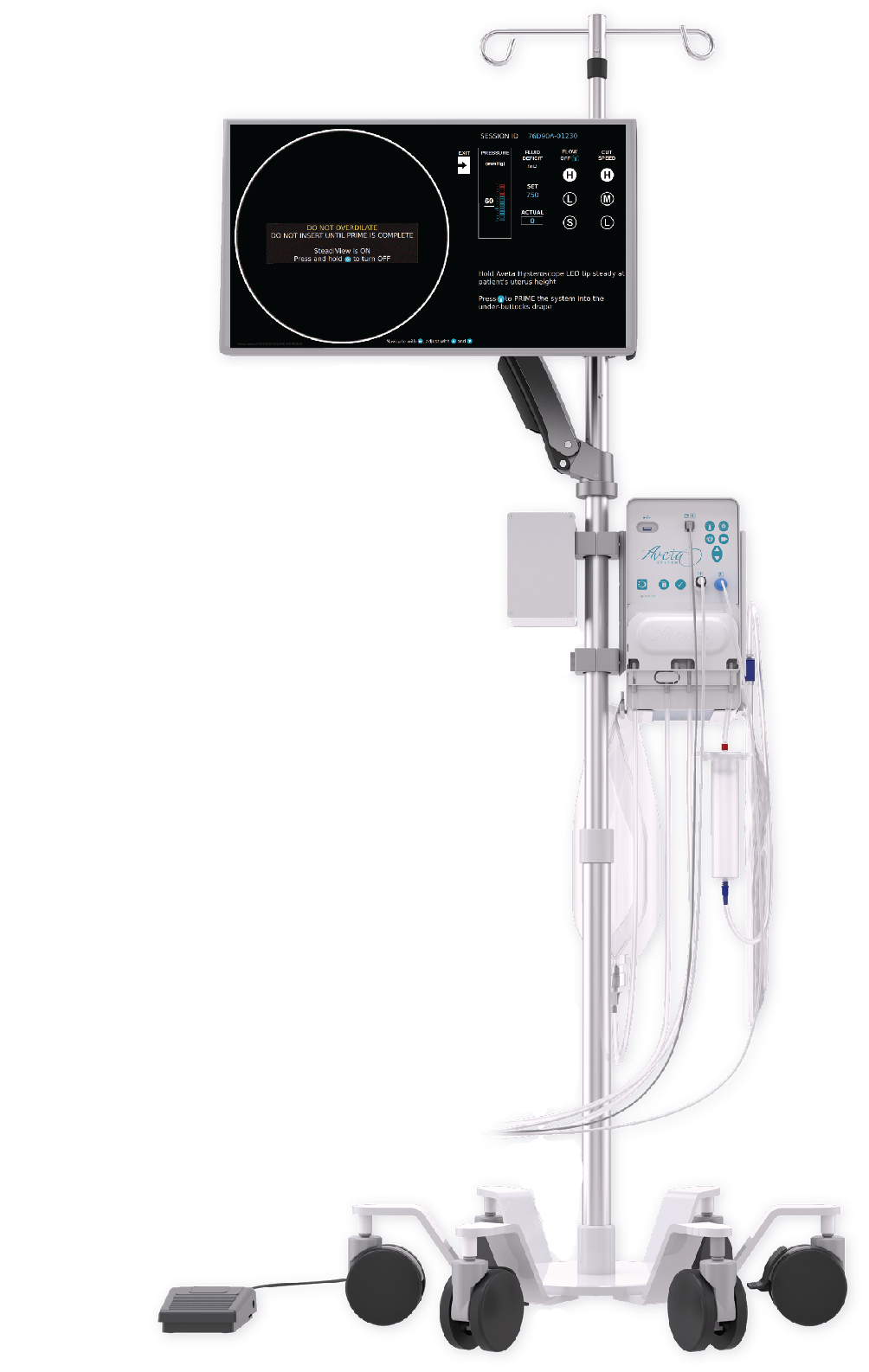 Aveta® System — Aveta® System