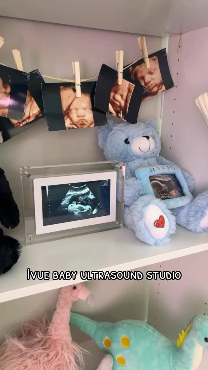 Ivue Baby We Provide 3D 4D 5D Ultrasound Gender Determination Test Ivue Baby We Provide 3D 4D 5D Ultrasound Gender Determination Test