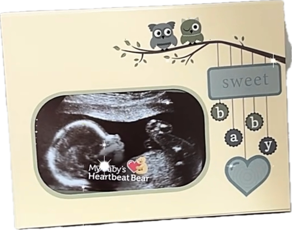 Ivue Baby. We provide 3D/4D/5D Ultrasound & Gender Determination test ...