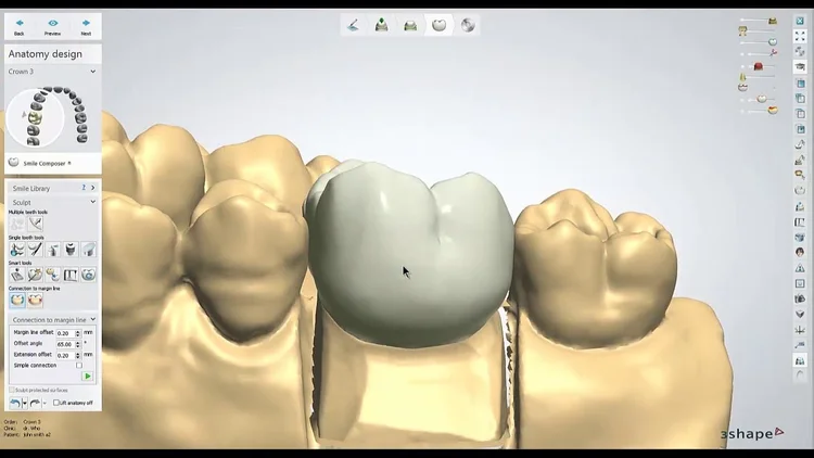 Home - OurCrown Dental - Permanent 3D Crown in an hour