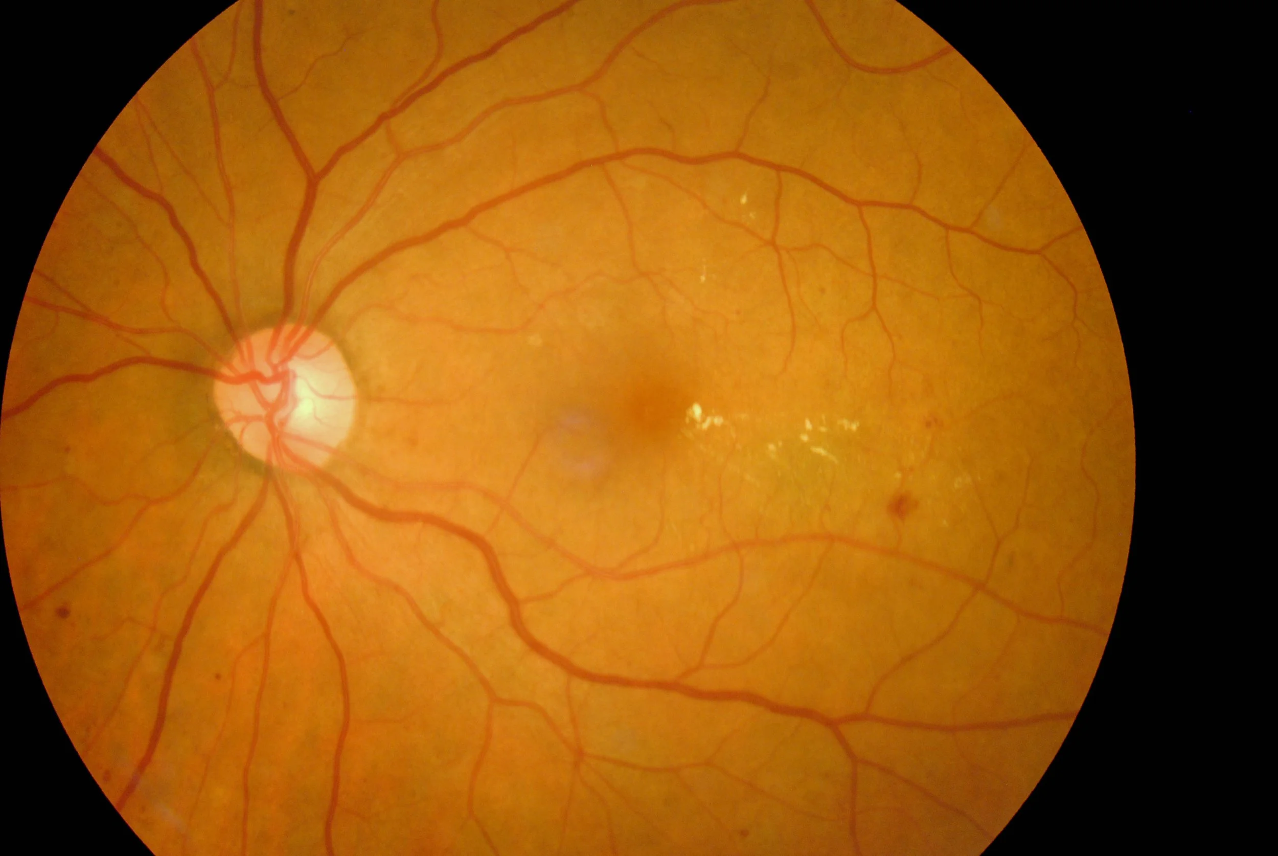 About — Retina Associates of Southern Utah