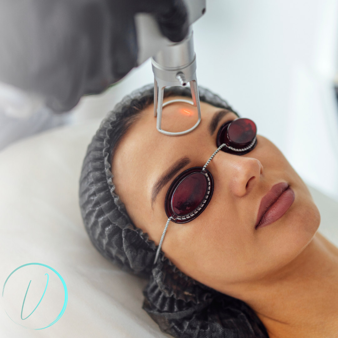 Laser Resurfacing — VITAL AESTHETICS
