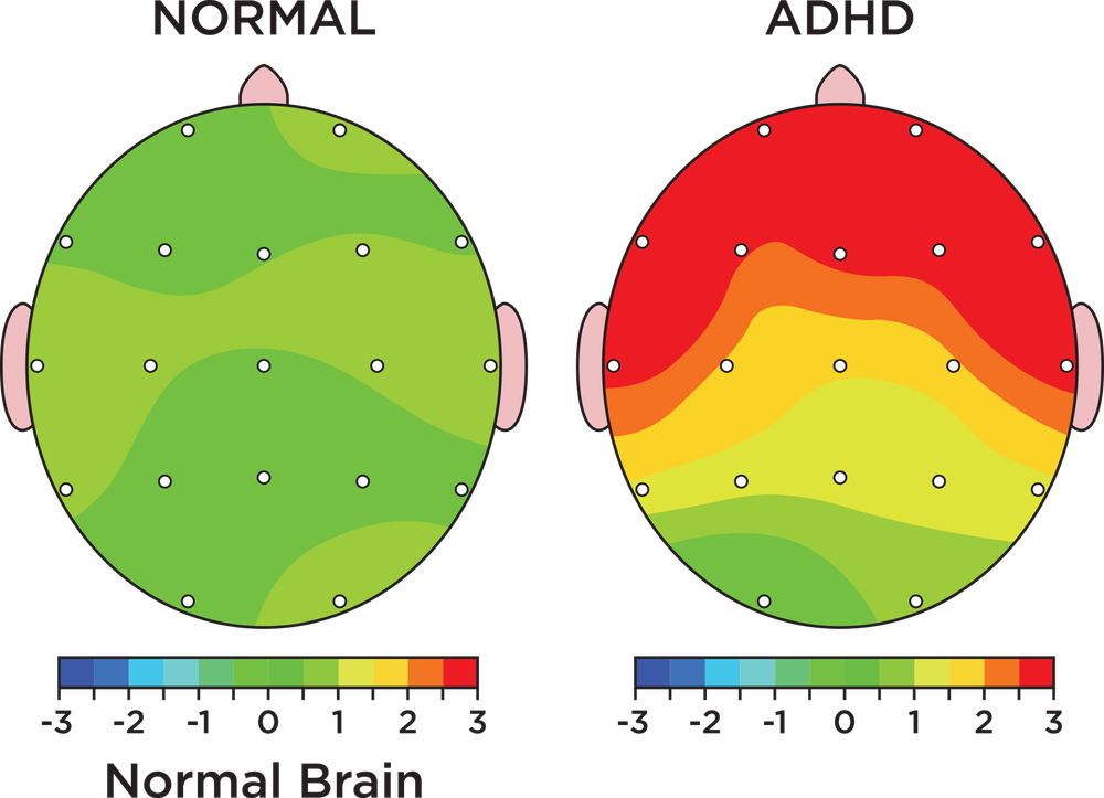 About — Genesis Brain Center