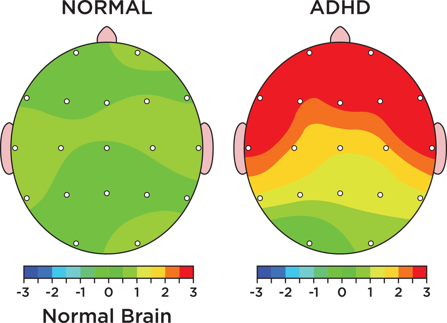 qEEG — Genesis Brain Center
