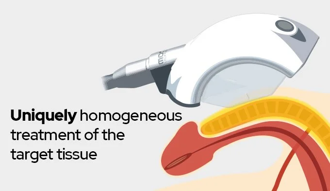 TriForce Wave Therapy