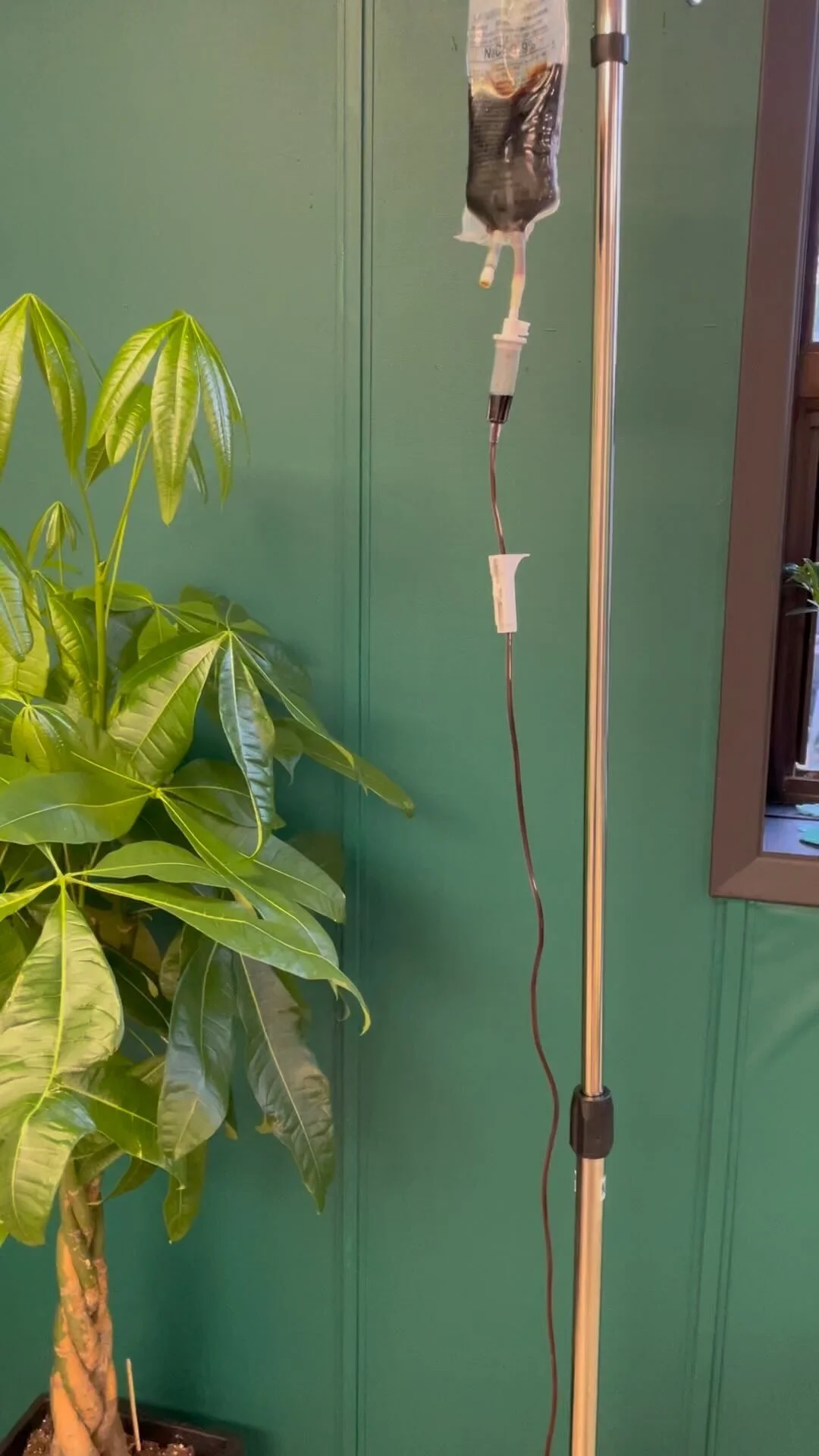 "Iron Infusion: The Suitability Beyond Microcytic Anemia" — Atheria ...