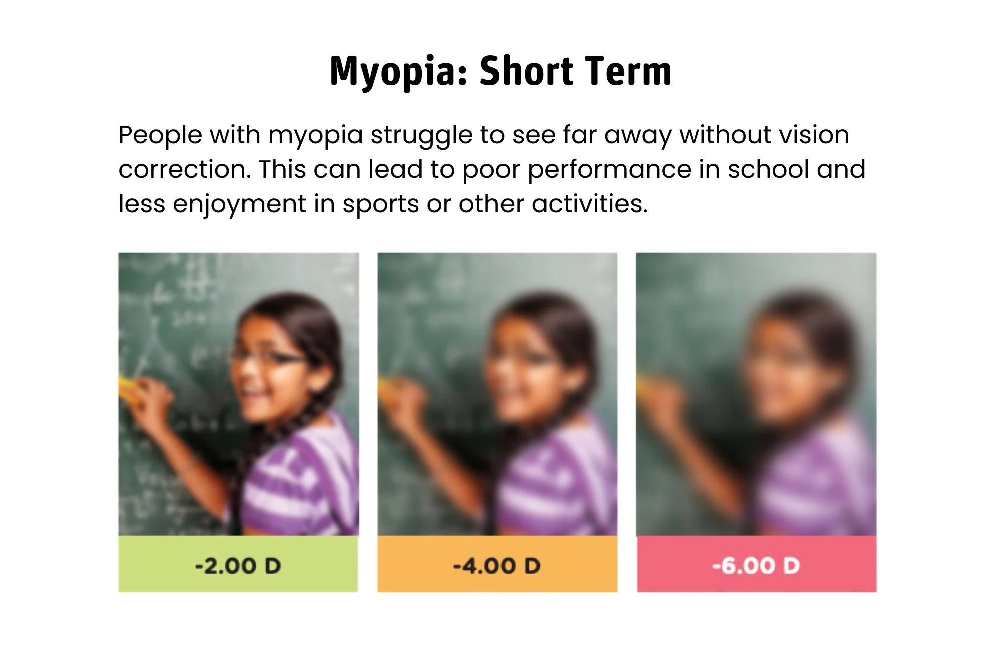 Myopia (Nearsightedness) Control and Ortho-K in Daly City — Clear Vision Eyecare