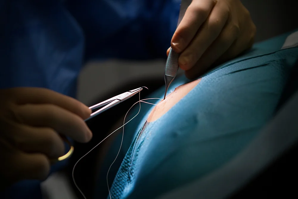 Surgical — Morgan Creek Dermatology