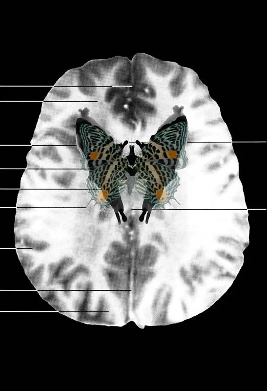 MRI Butterfly — Suzanne Anker
