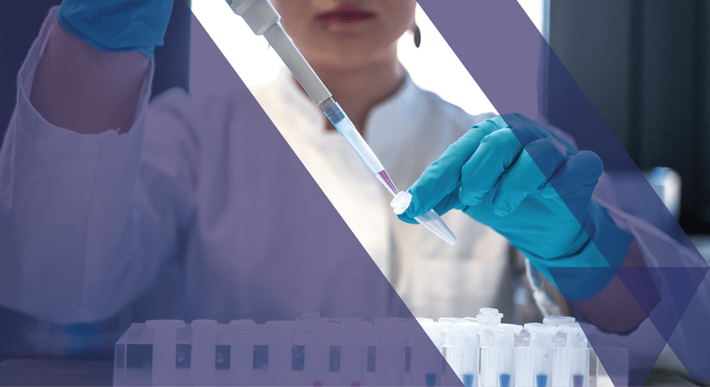 Recombinant Protein Purification — Proteios Technology
