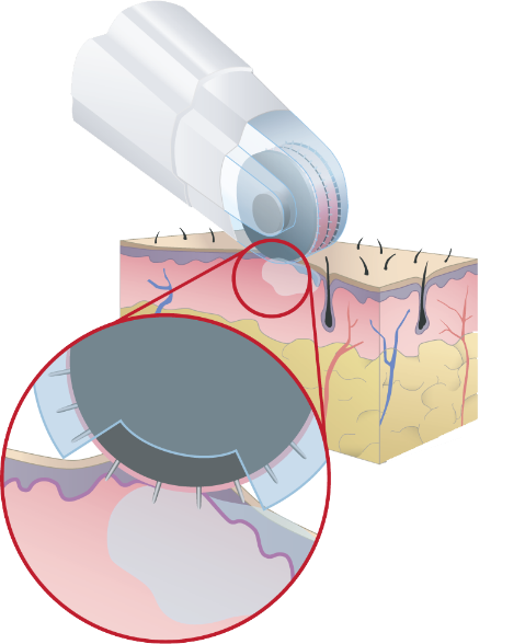 Training — Genesis Biosystems