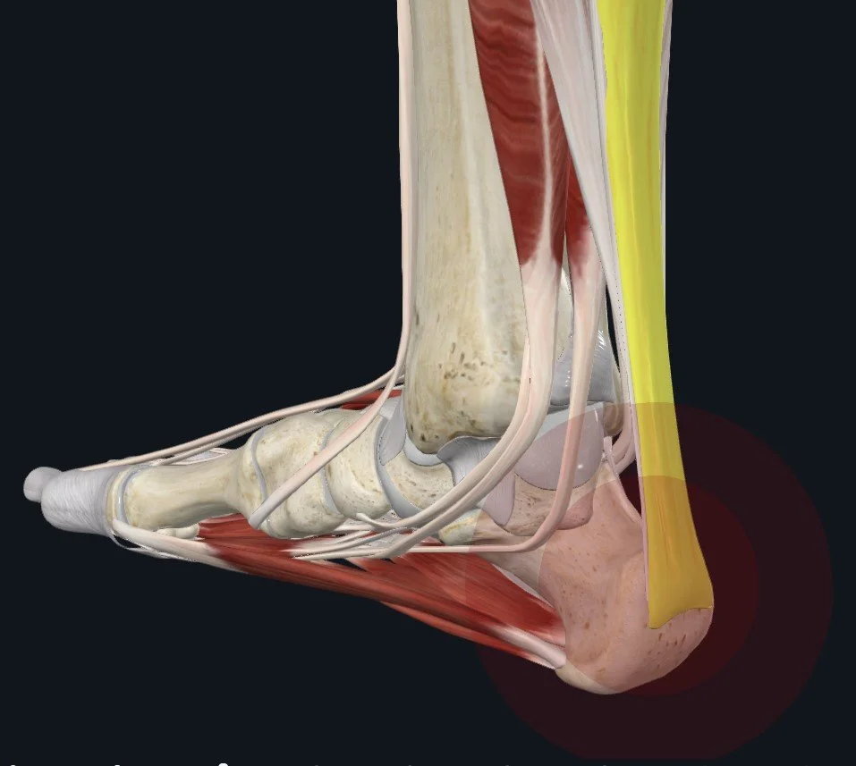 Douleurs au talon : Origine, diagnostic et traitement ...