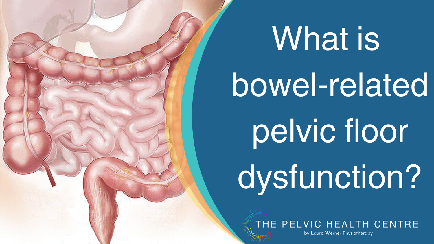 What is bowel-related pelvic floor dysfunction? — Laura Werner ...