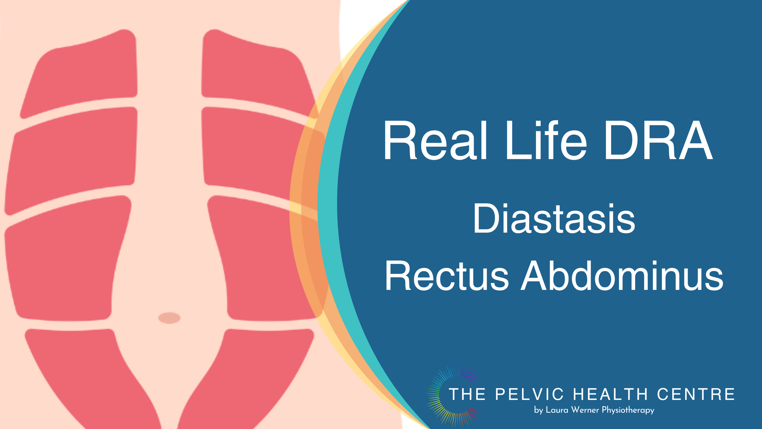 Real Life DRA (Diastasis Rectus Abdominis) — Laura Werner Physiotherapy