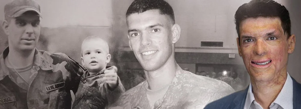 Army Officer Sam Brown Survives Explosion in Afghanistan, Lives to ...