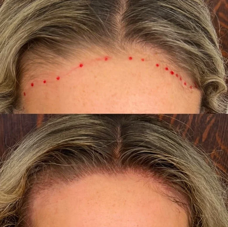 Services — Dermagraphics by Miller