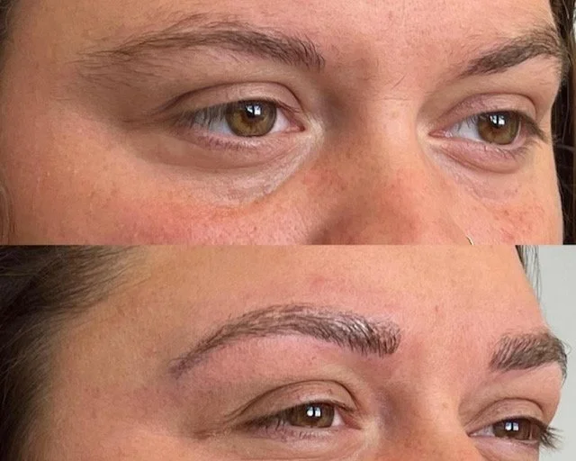 FAQs — Dermagraphics by Miller