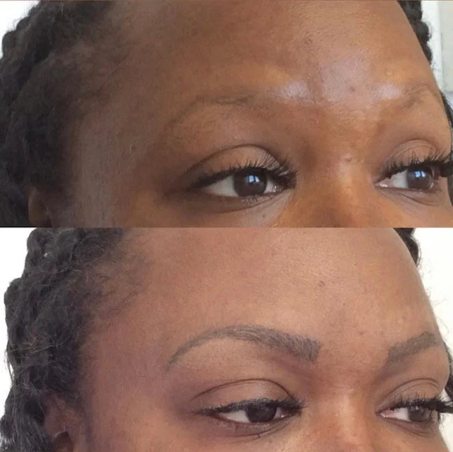 Dermagraphics Portfolio — Dermagraphics by Miller