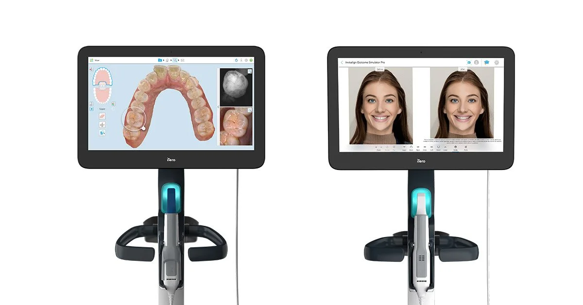 Scanner Intraorale Digitale — Gb Dental S.r.l