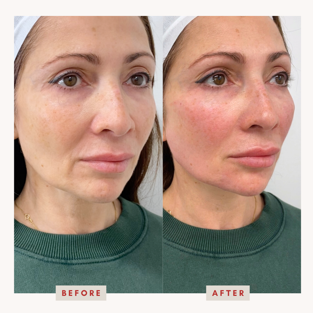 Clemens Face + Body | Boston's Top Rated Botox®, Skincare & Aesthetic ...