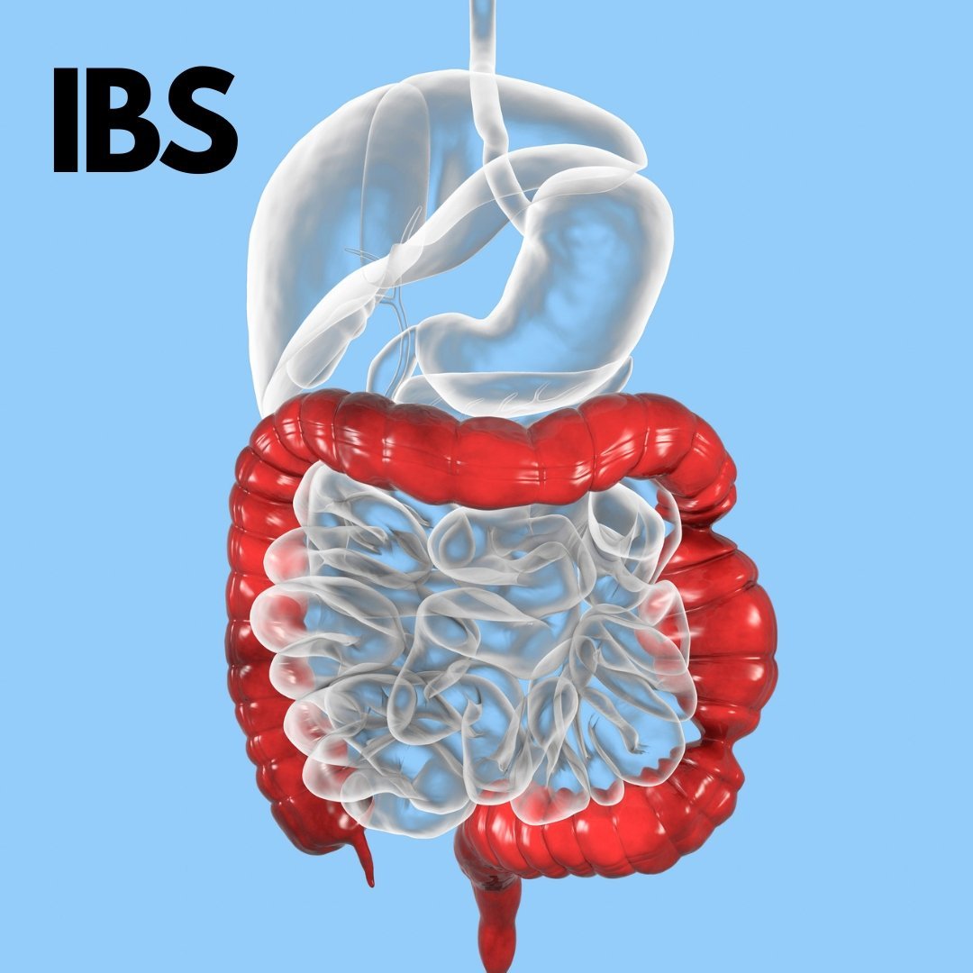 A Holistic Approach to Freedom from IBS: Uniting Functional Nutrition ...