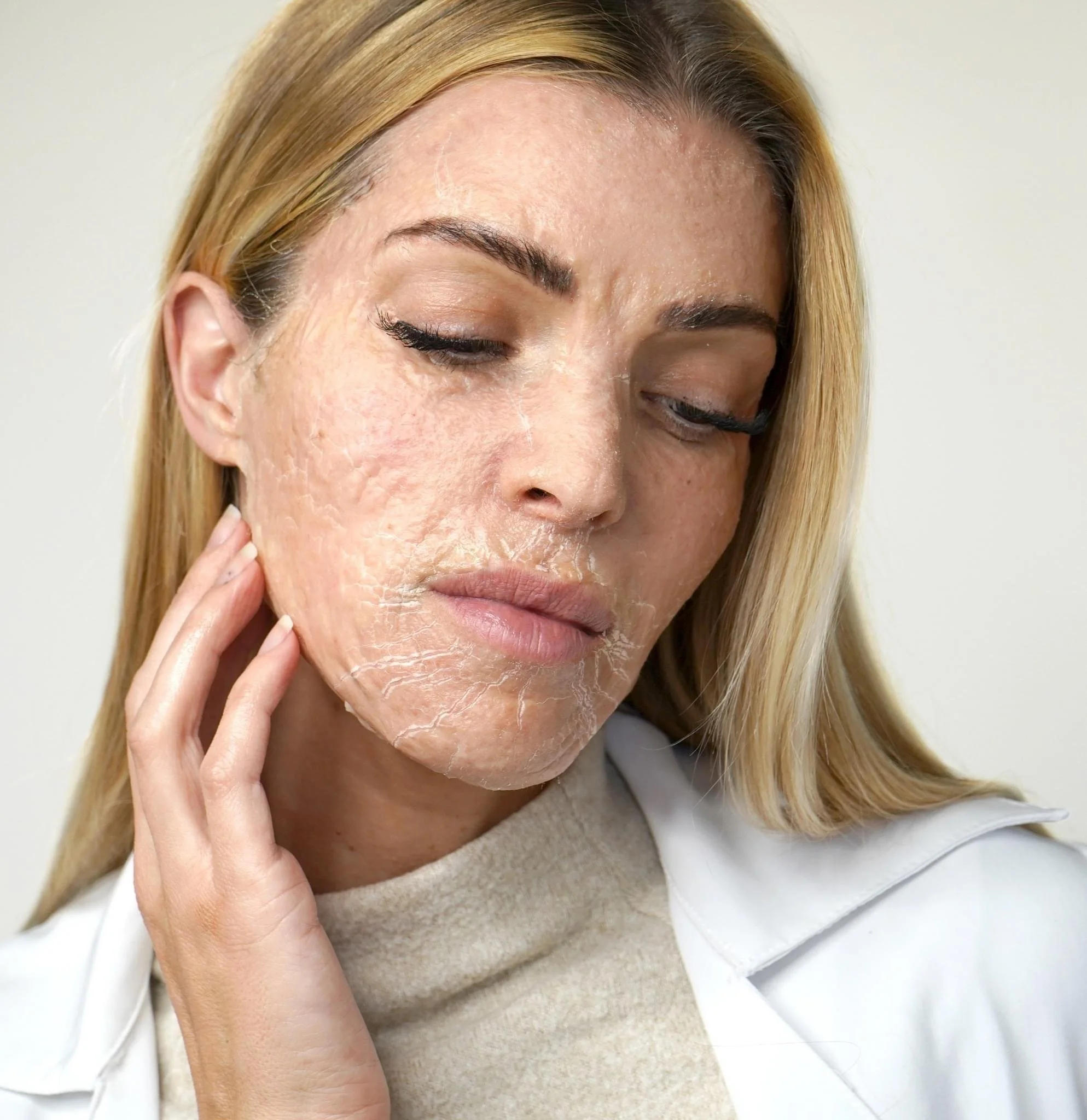 Services 3 — Lasoderme