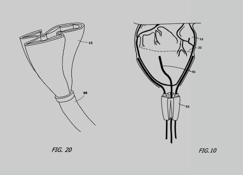 Myocardial Strain Technologies
