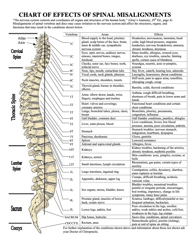 Misalignment Chart — Monument Chiropractic