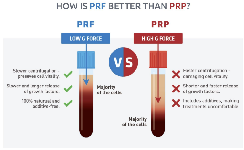 PRP/PRF Treatment — Viva Beauté - Cosmetic Injectibles - Skin Beauty ...