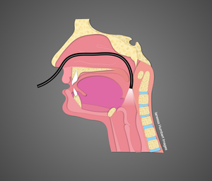 Services — Swallowing Wellness