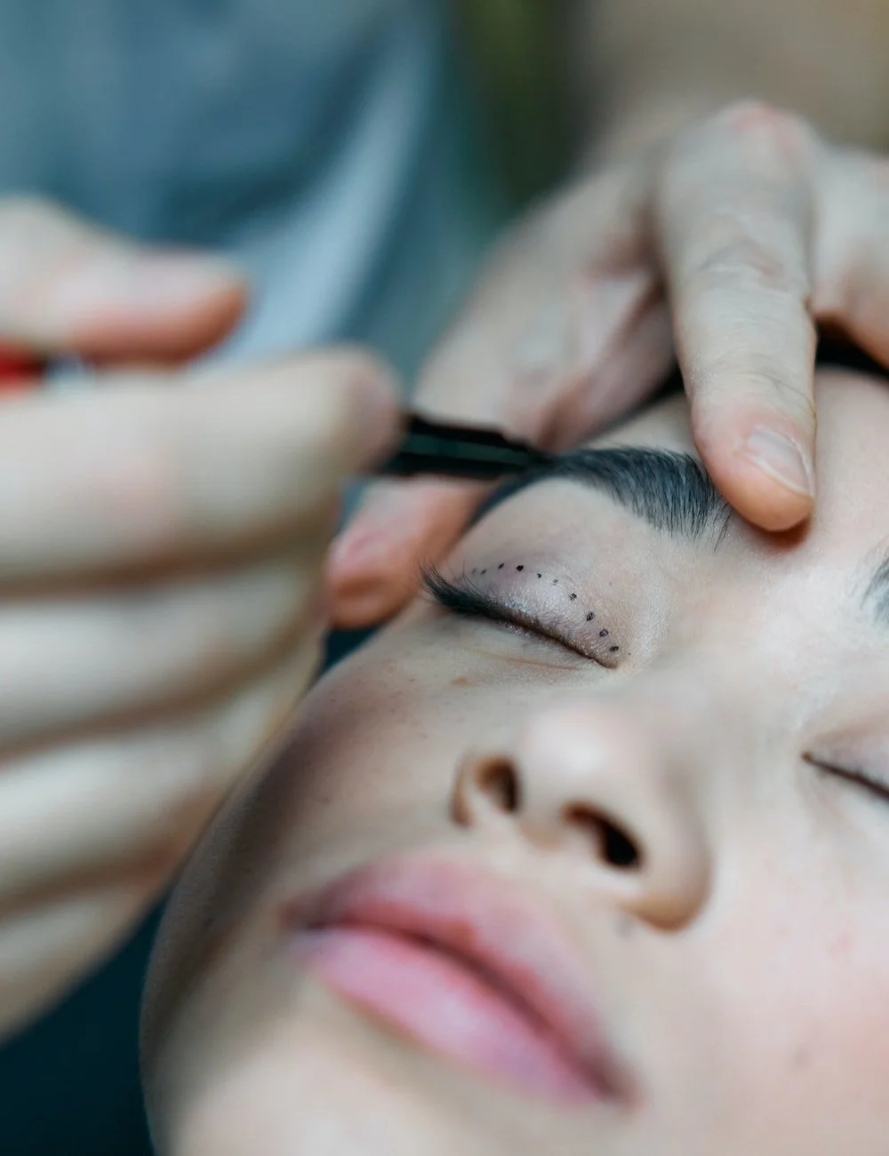 Blepharoplasty — Vik Patel