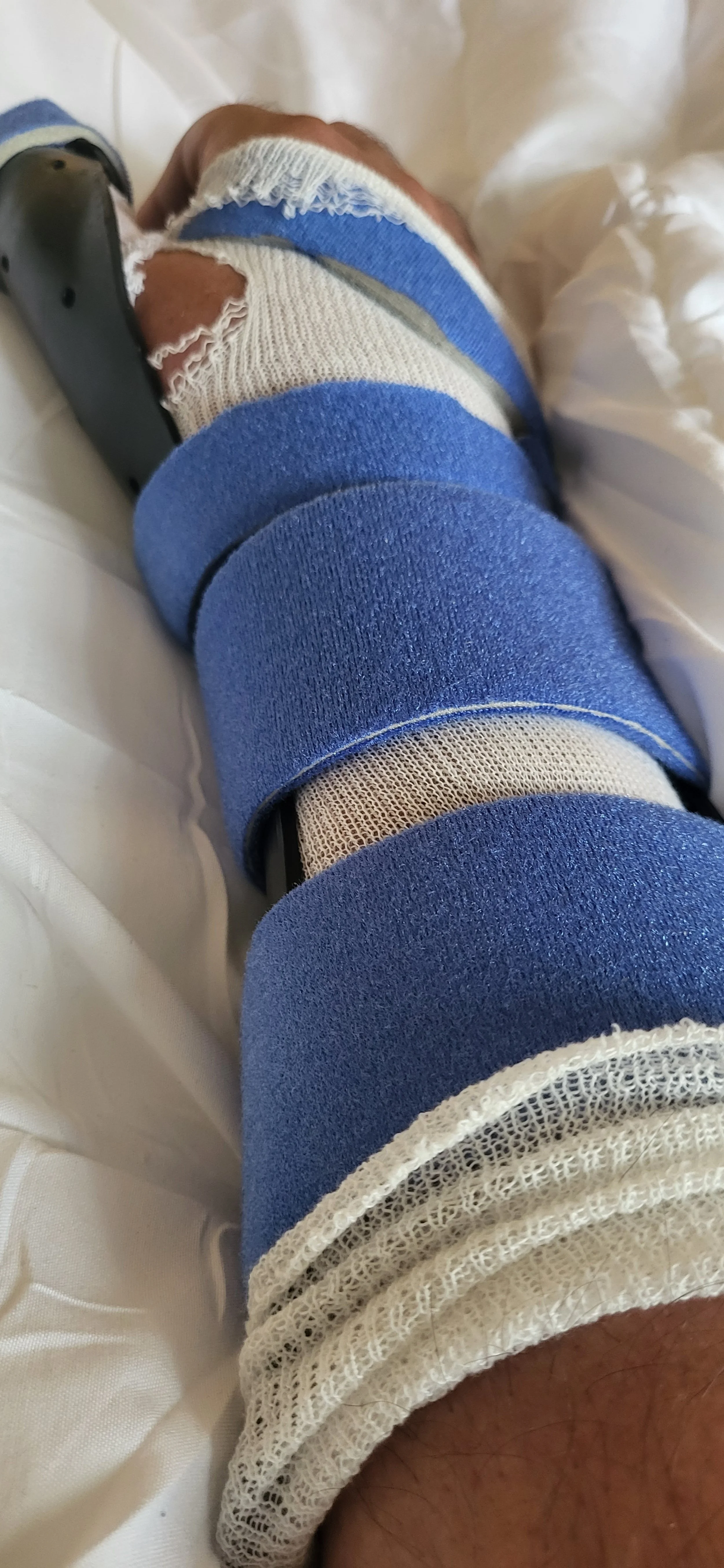 Post-Op Physical Therapy Treatments — CoreMovement Physical Therapy ...