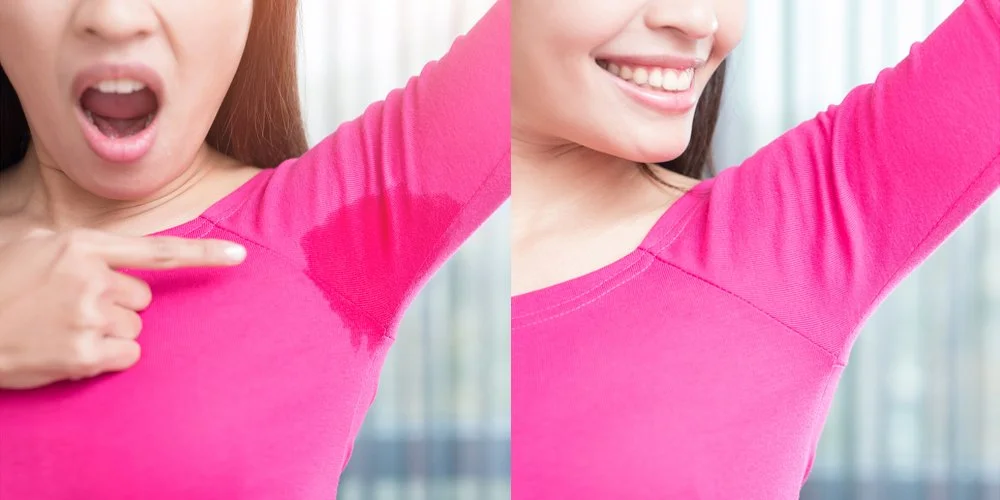Manage excessive underarm sweating near me | Torrance, CA — Lumier Medical