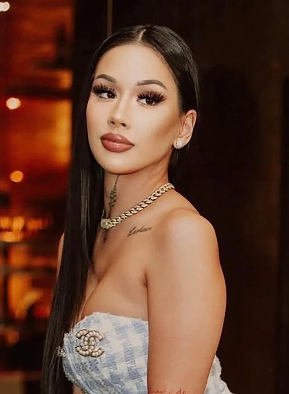 Dermal Fillers | Enhance Your Appearance Today — Medica by Maria