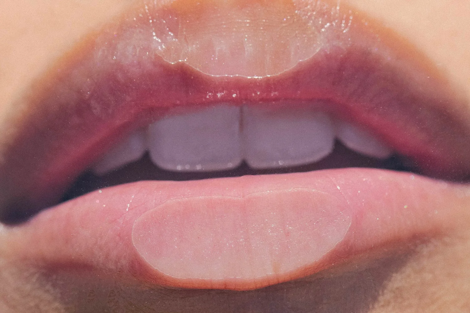 The Glam Nurse: Premier Beauty Treatments - Botox, Fillers, & More