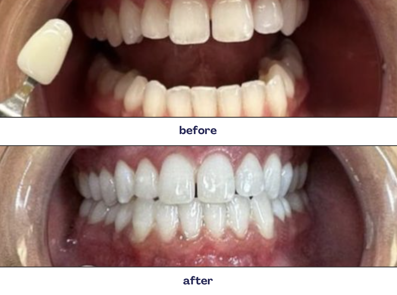 Tooth Be Told Dental Hygiene Studio