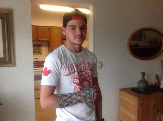 Lifeguard Returns To Work With ActivArmor 3D Printed Cast | ActivArmor