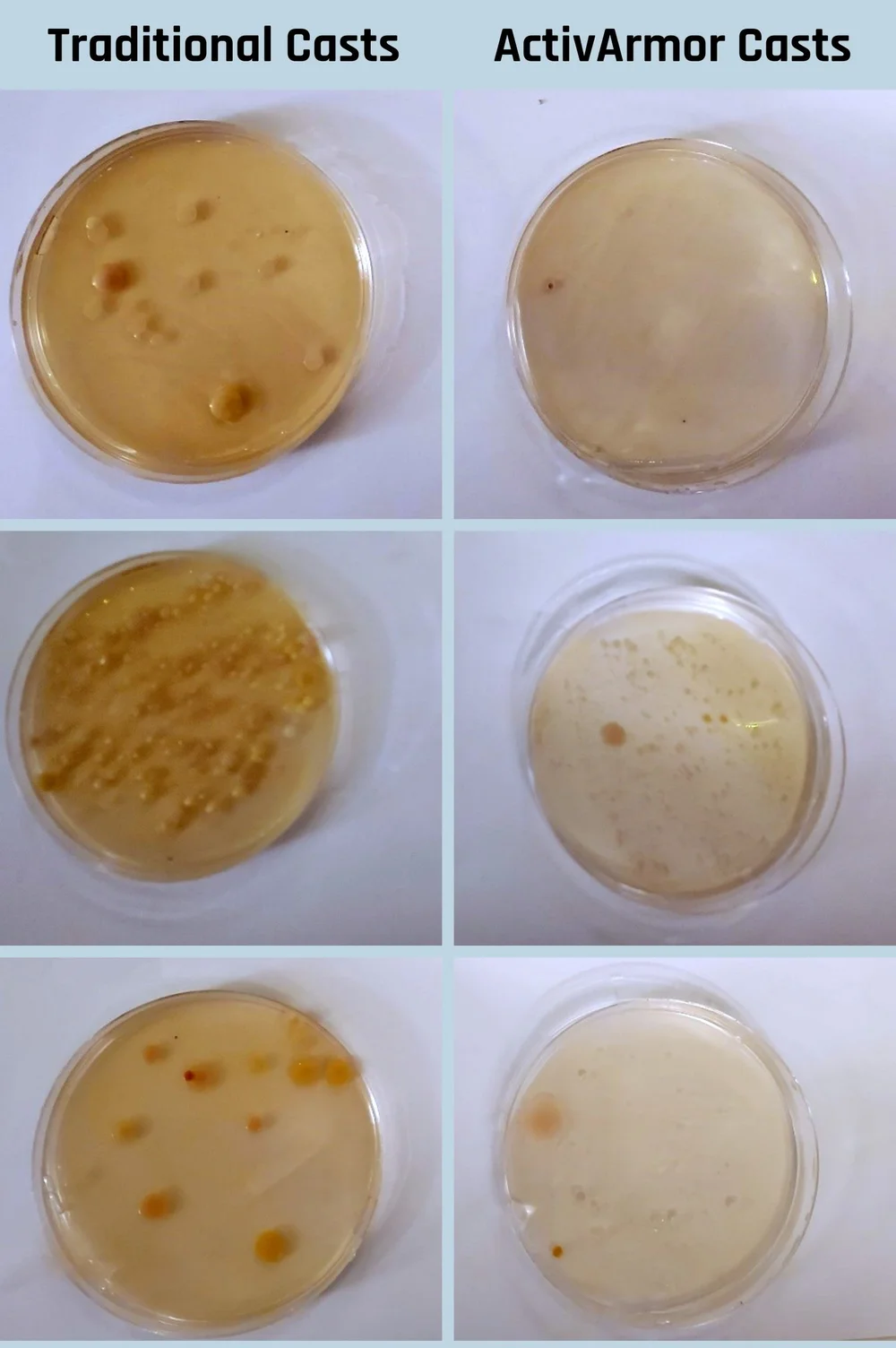 Traditional Casts vs Waterproof Casts | ActivArmor
