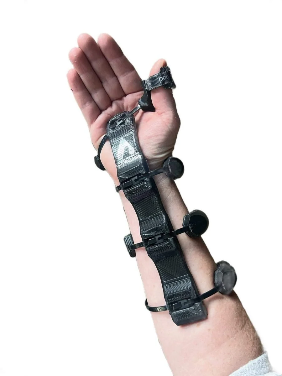 Insta-Armor | ActivArmor | Custom 3D-Printed Casts and Splints