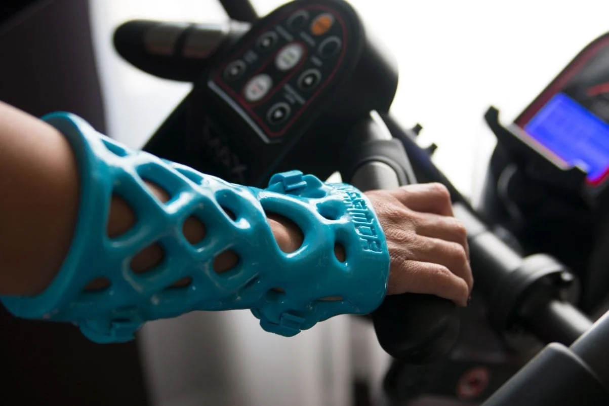 ActivArmor Transitions From Cast To Splint Through Healing Phases ...