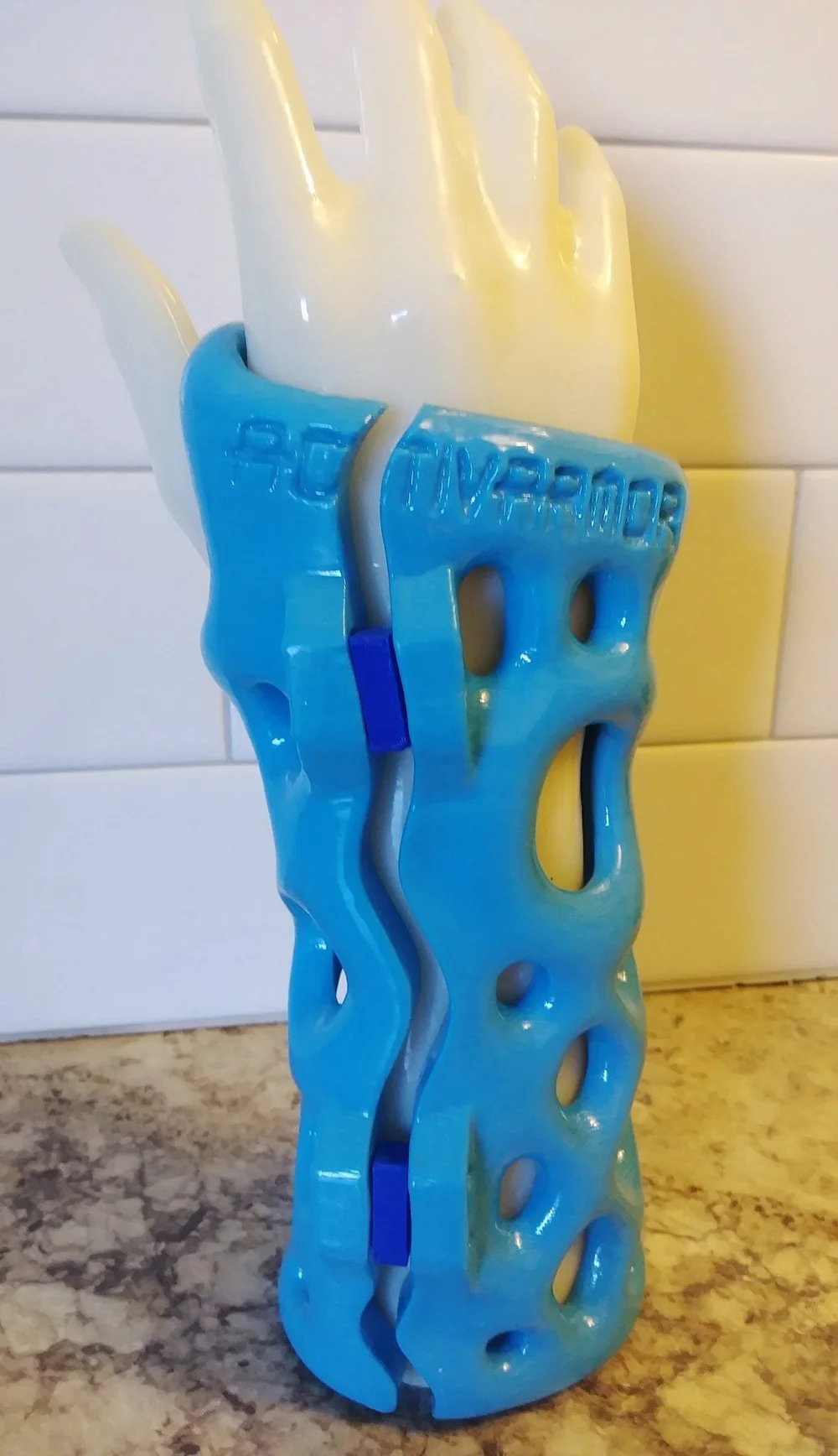 ActivArmor 3D printed casts accommodates for Edema (Swelling) | ActivArmor