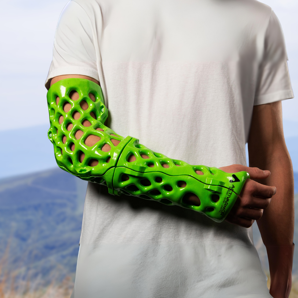 For Patients | ActivArmor | Custom 3D Printed Casts and Splints