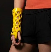 For Patients | ActivArmor | Custom 3D-Printed Casts and Splints