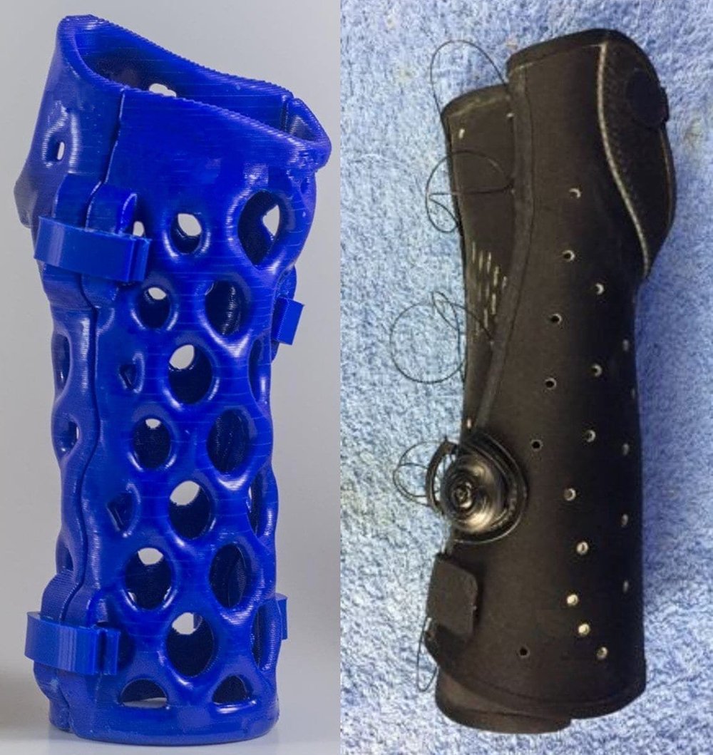 How Does ActivArmor Compare to Off-the-Shelf Splints? | ActivArmor