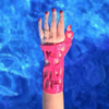 For Patients | ActivArmor | Custom 3D Printed Casts and Splints