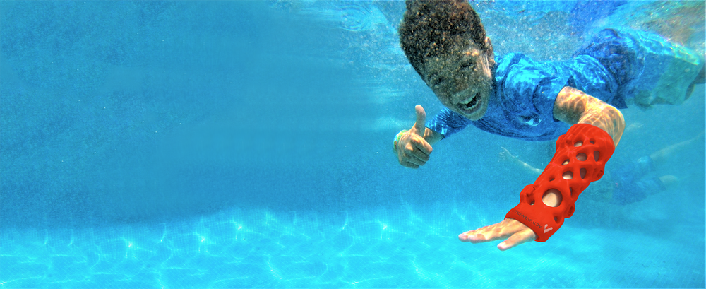 ActivArmor | Custom 3D Printed Casts and Splints