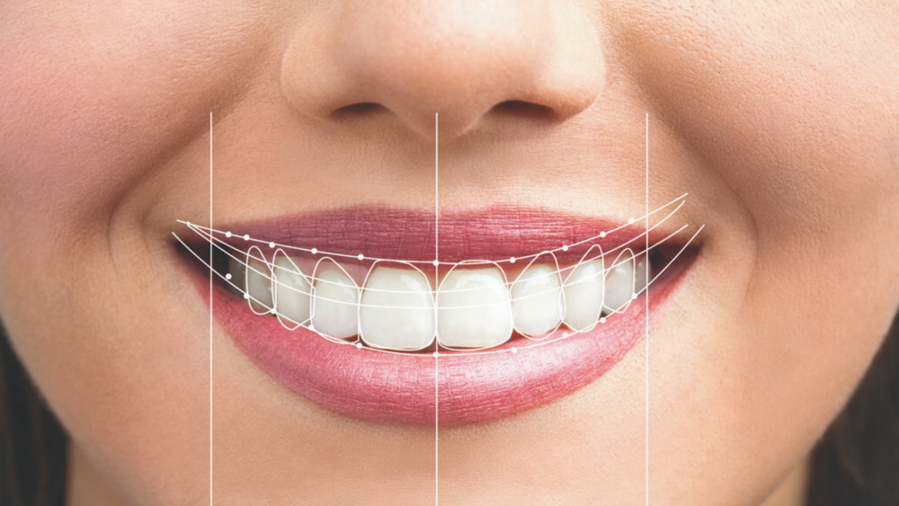 Lynwood.Dental - Washington — Lynwood Dental