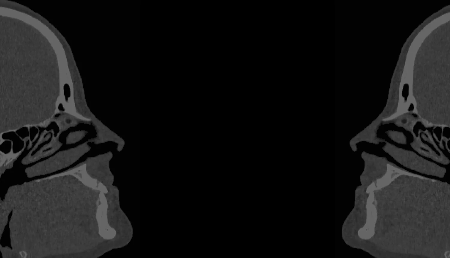 Home — International Society of Forensic Radiology and Imaging