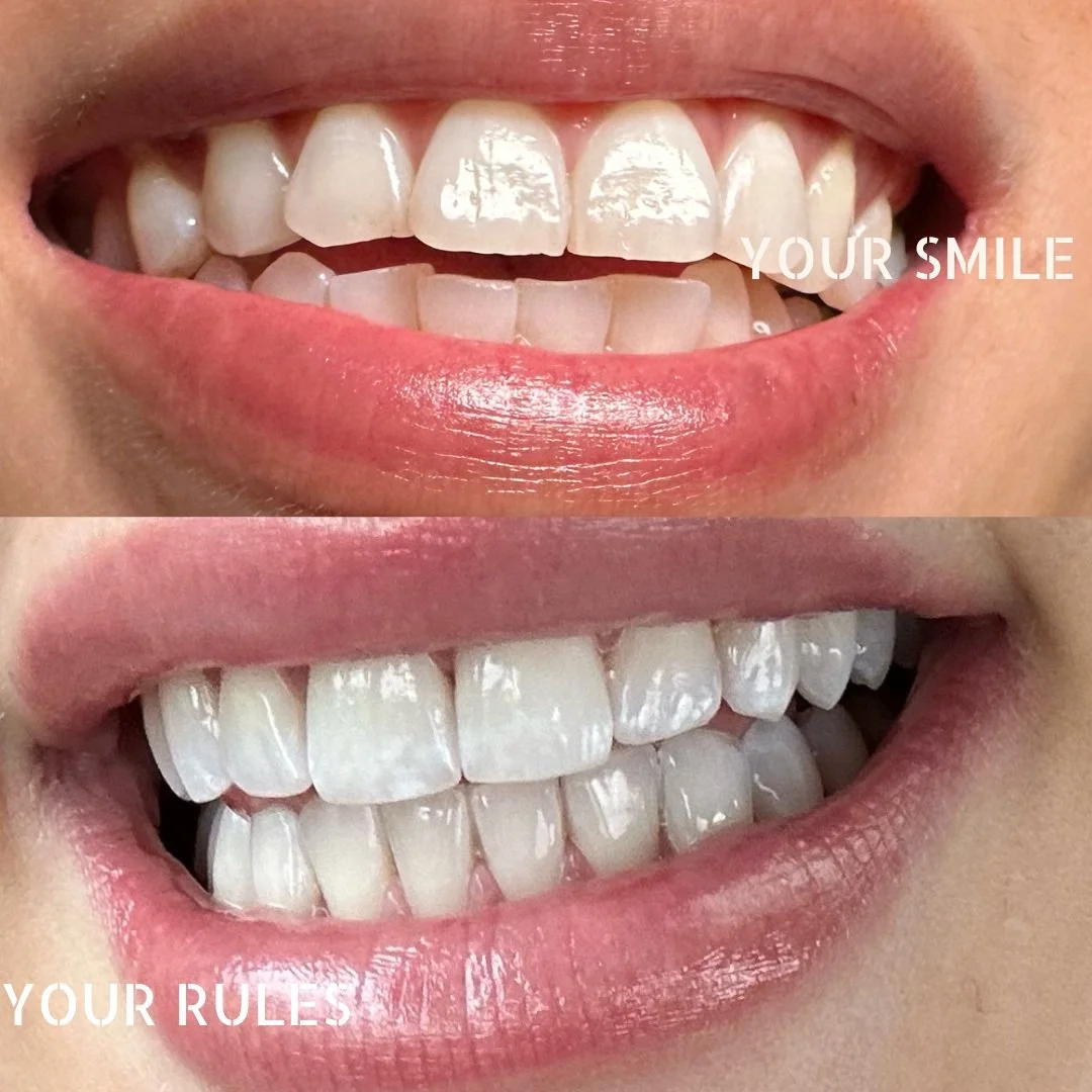Stunning Smiles -Professional Mobile Teeth Whitening To You